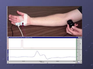 Emg fundamental | PPT