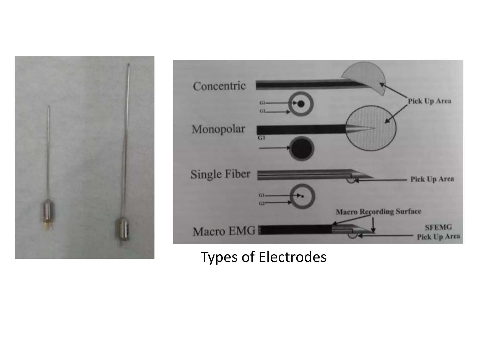 Emg presentation | PPTX