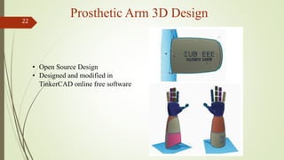 EMG controlled Prosthetic Arm | PPTX