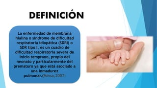 Enfermedad de la Membrana Hialina | PPTX