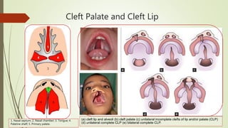 Embryology Head and Neck | PPTX
