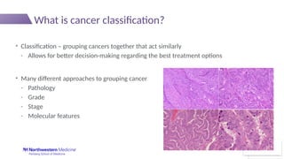 Immunotherapy and Uterine Cancer: What Patients Should Know | PPTX
