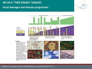 Multiple sclerosis as a simultaneous "2 components" disease | PPTX ...