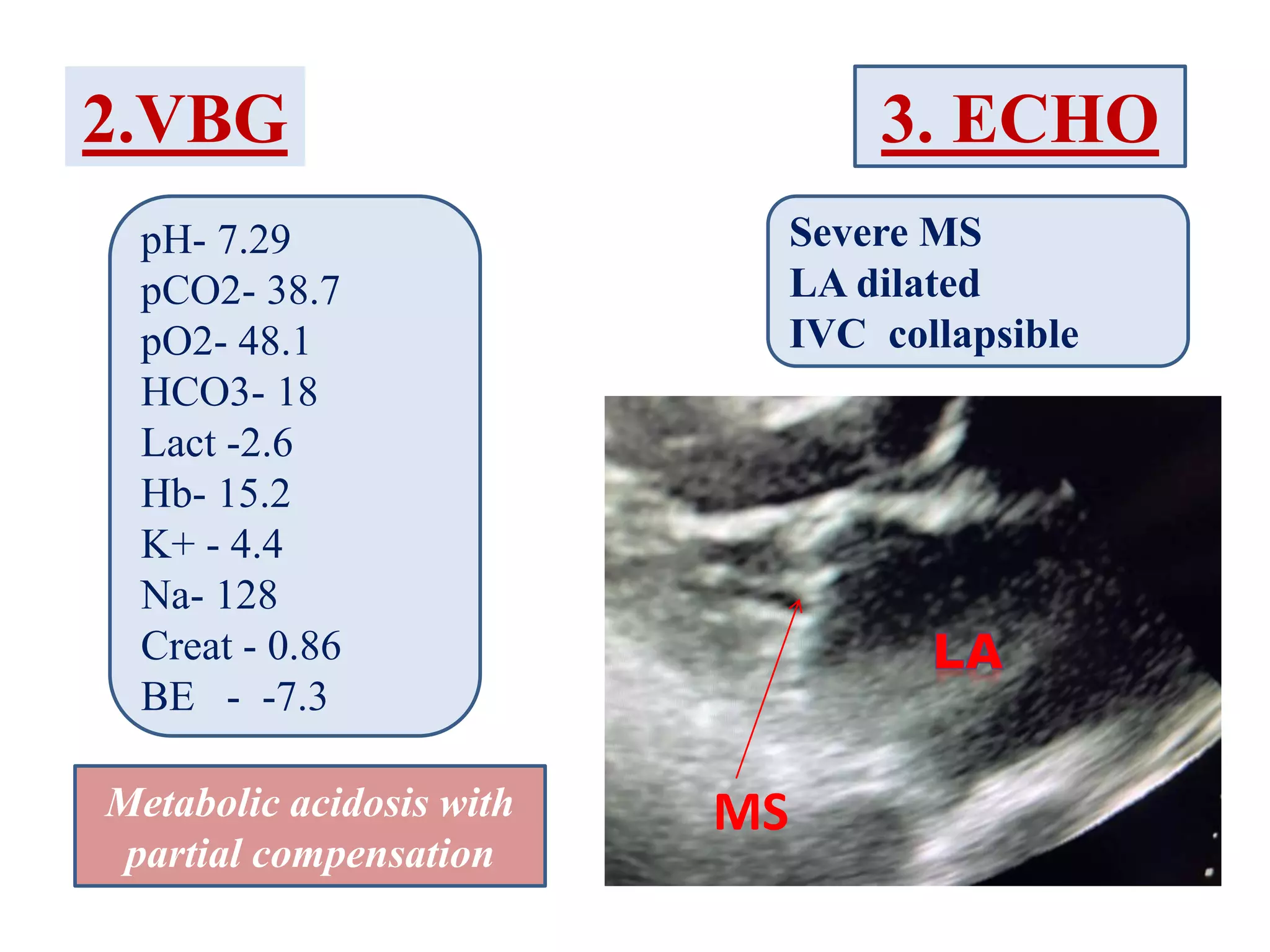 splenic infarct | PPT