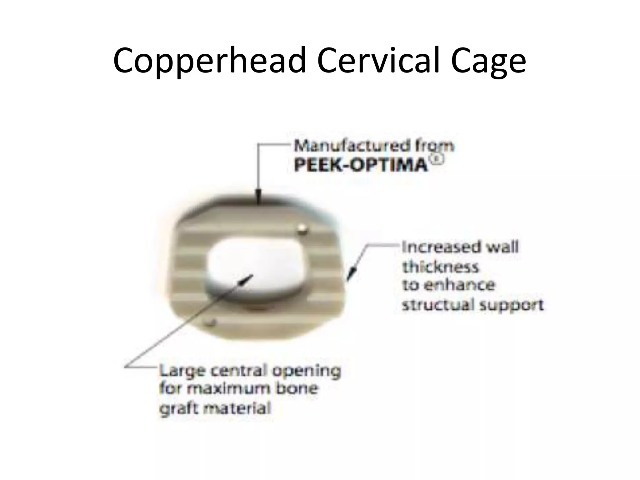 Eminent spine-copperhead | PPTX