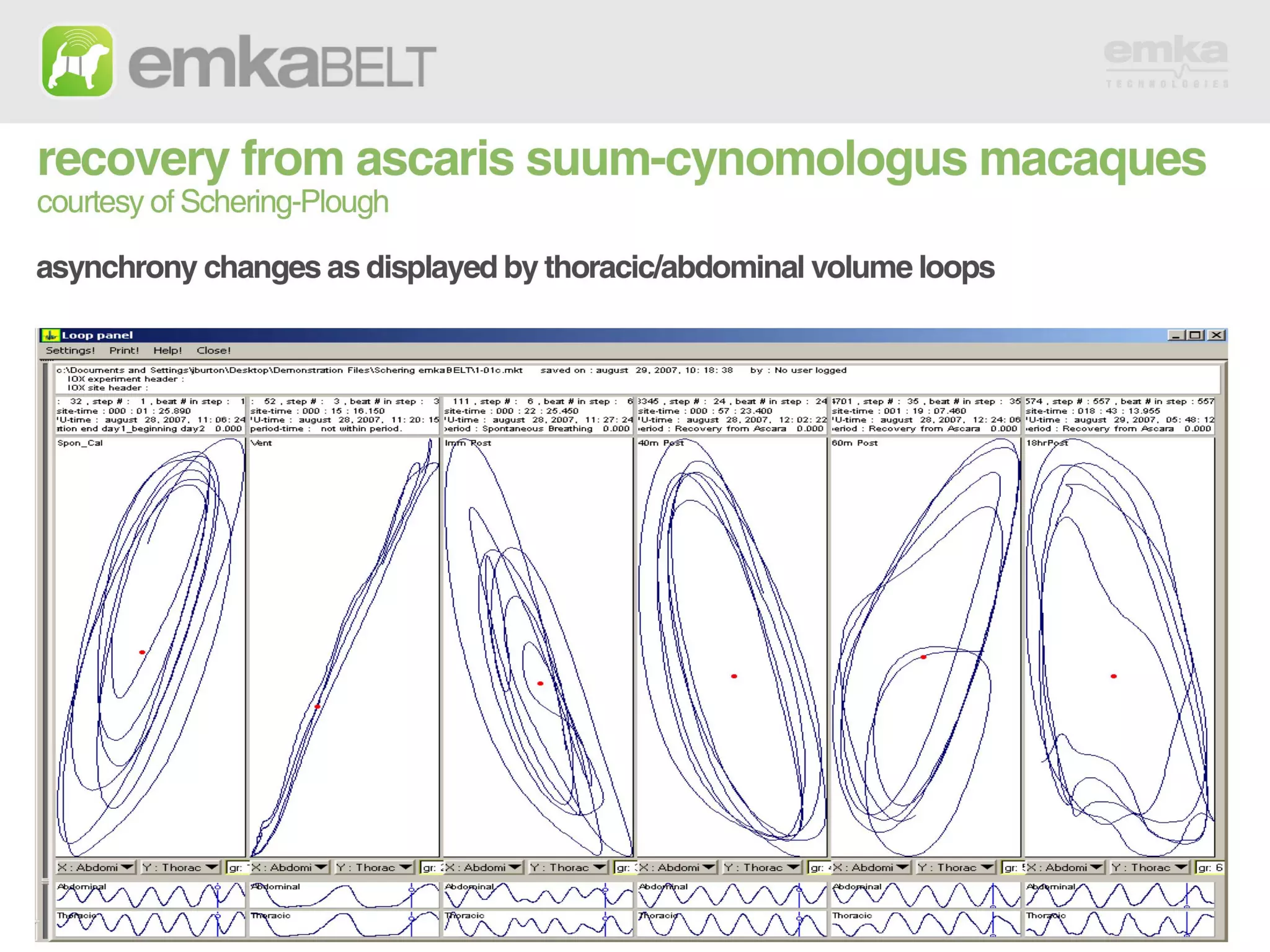 emka TECHNOLOGIES - Telemetry - emkaBELT noninvasive telemetry ...