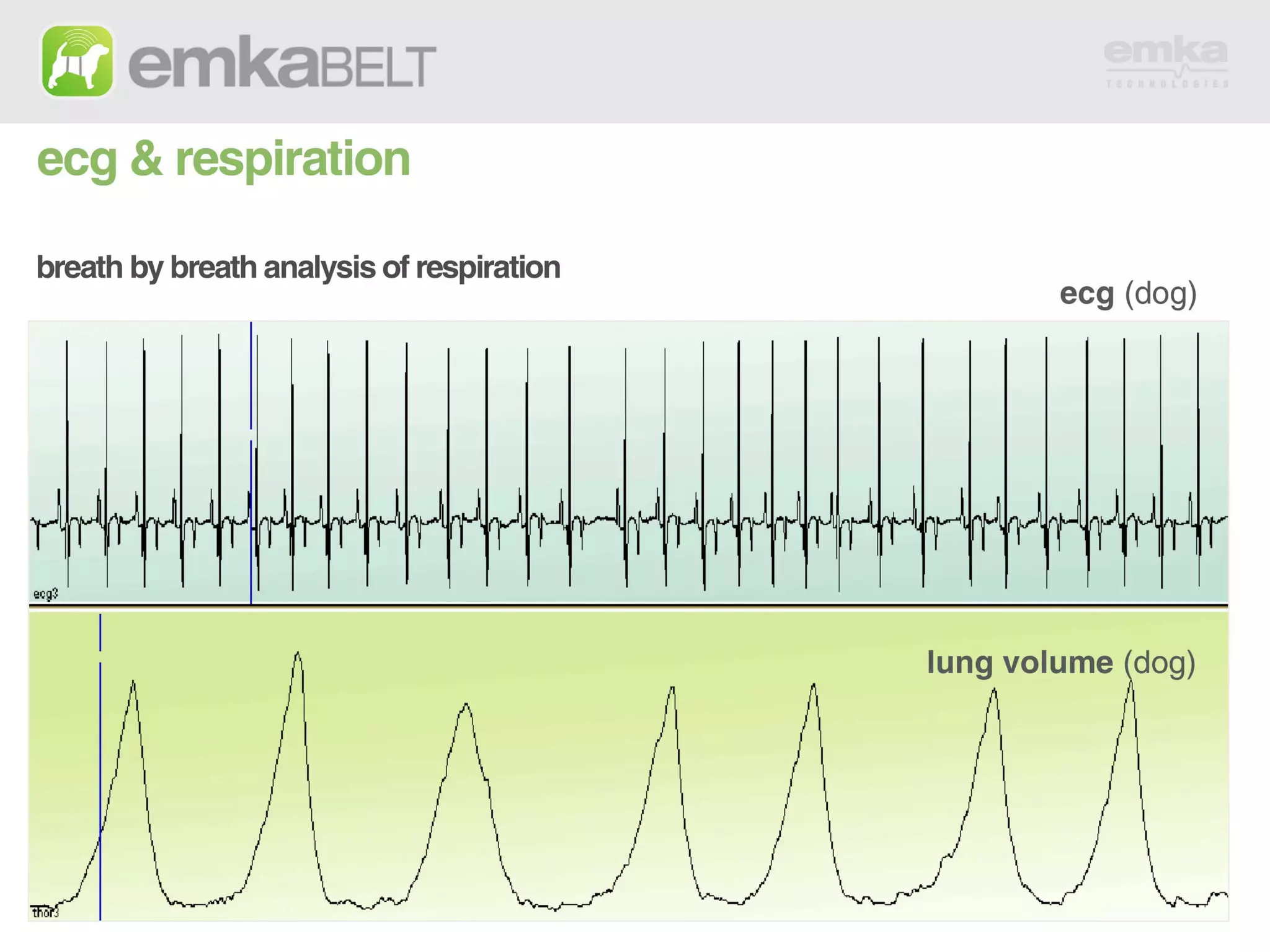 emka TECHNOLOGIES - Telemetry - emkaBELT noninvasive telemetry ...