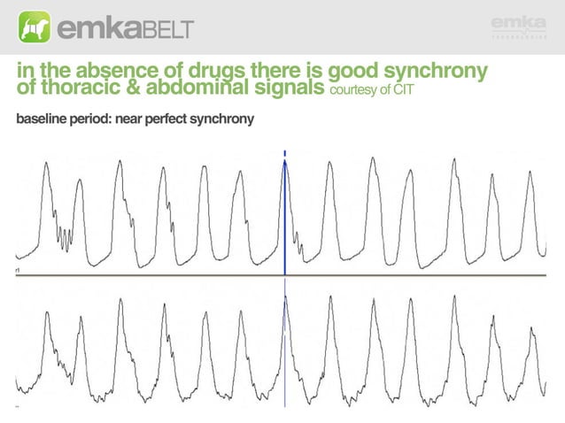 emka TECHNOLOGIES - Telemetry - emkaBELT noninvasive telemetry ...