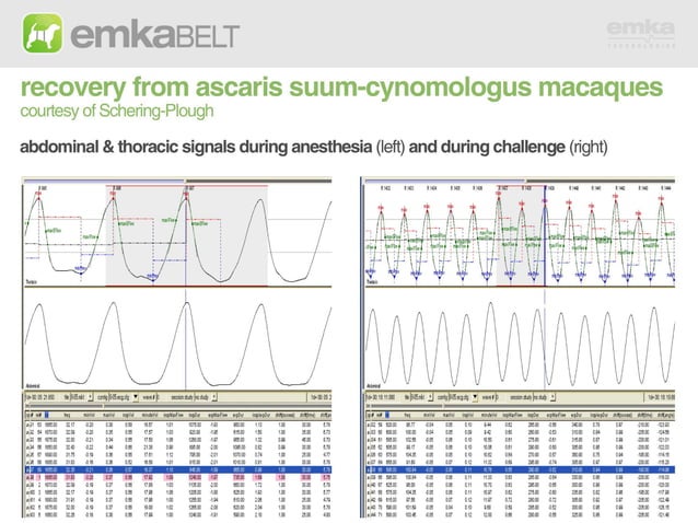 emka TECHNOLOGIES - Telemetry - emkaBELT noninvasive telemetry respiration measurement system | PDF