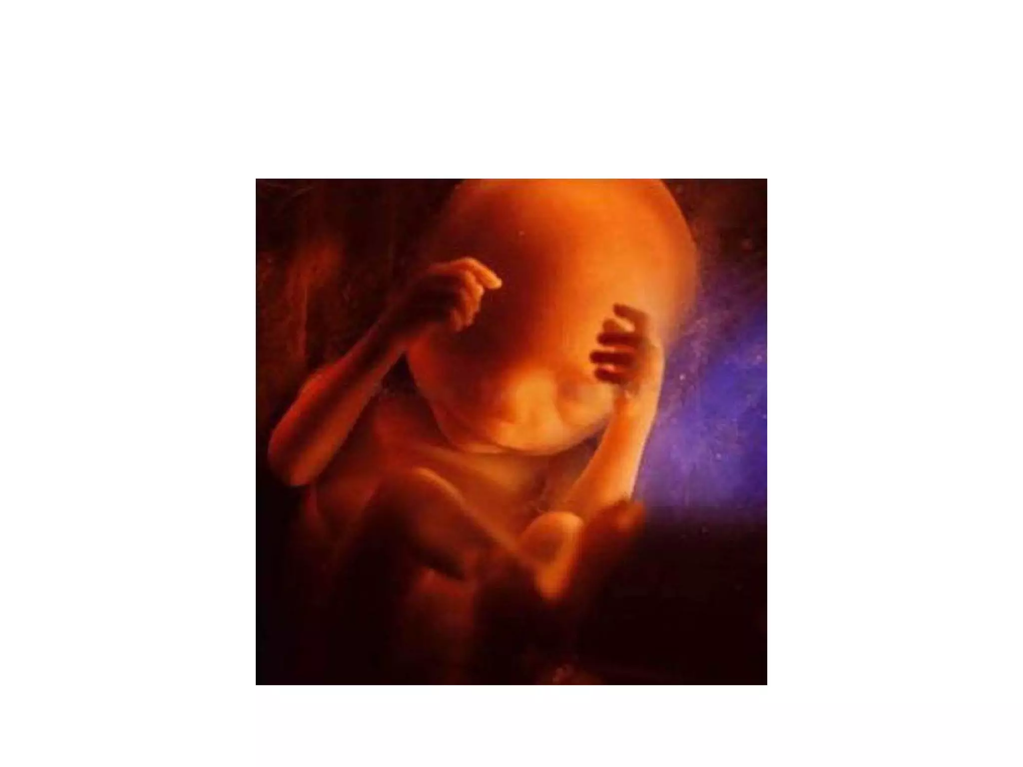 Training Emergency Obstetric Care | PPT