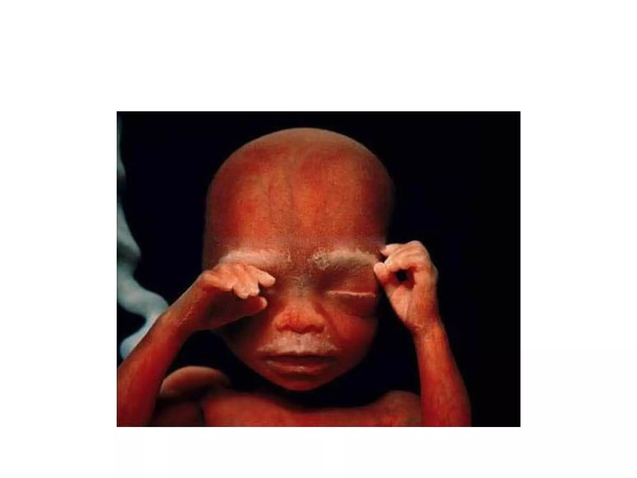 Training Emergency Obstetric Care | PPT
