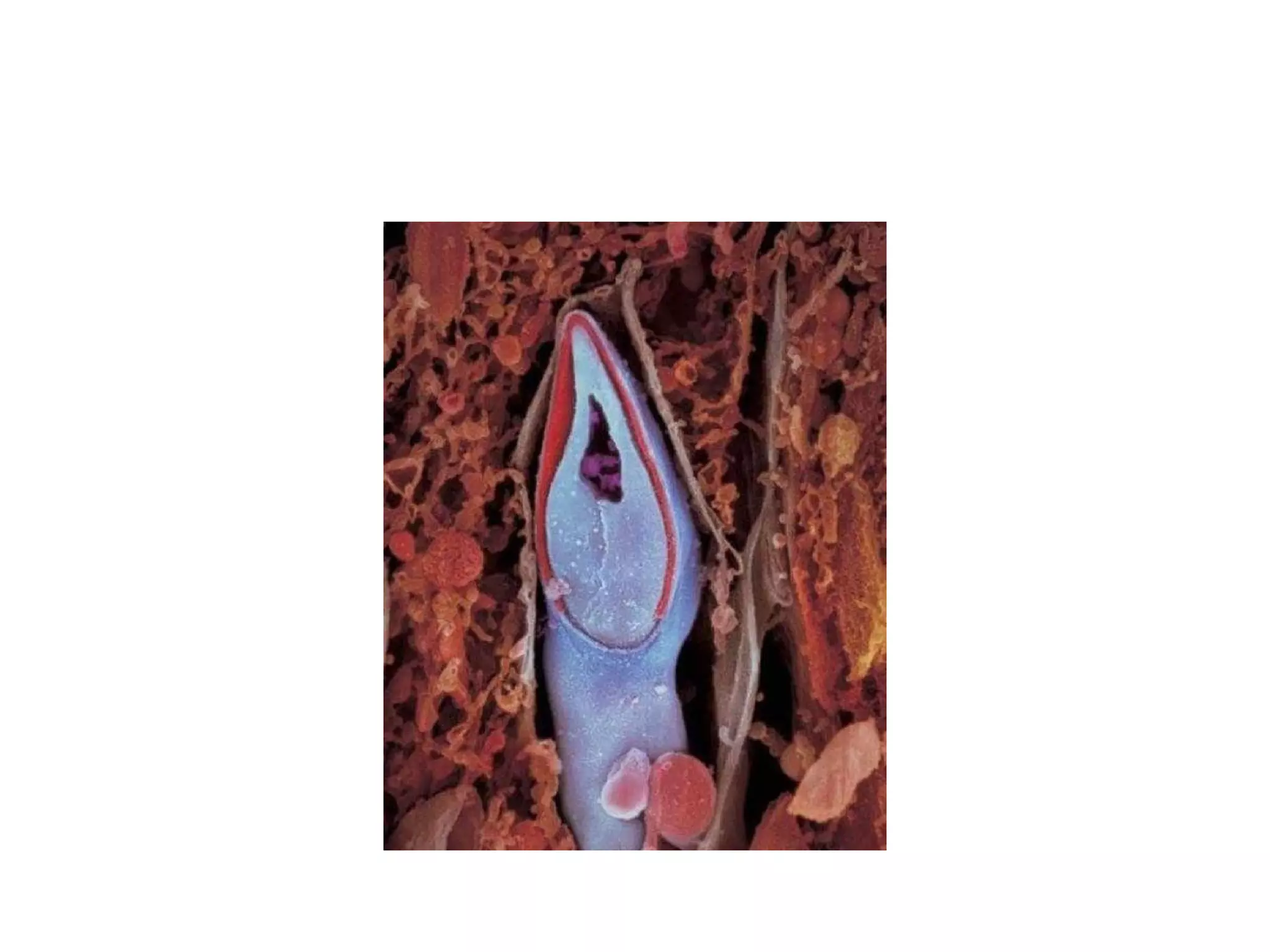 Training Emergency Obstetric Care | PPT