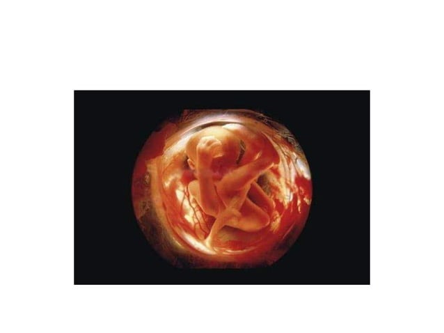 Training Emergency Obstetric Care | PPT