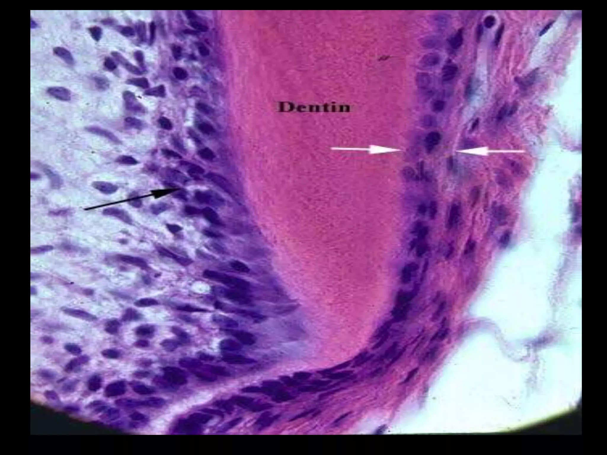 dentin pattern of mineralization, 1ry 2nd 3ry dentin formation and root ...