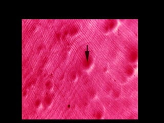 dentin pattern of mineralization, 1ry 2nd 3ry dentin formation and root ...