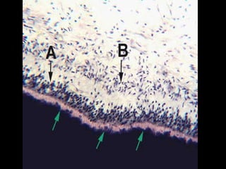 dentin pattern of mineralization, 1ry 2nd 3ry dentin formation and root ...