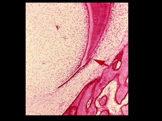 Dentin Pattern Of Mineralization 1ry 2nd 3ry Dentin Formation And Root