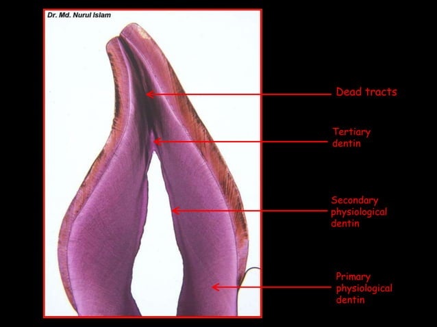 dentin pattern of mineralization, 1ry 2nd 3ry dentin formation and root ...