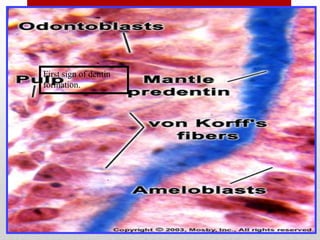 dentin pattern of mineralization, 1ry 2nd 3ry dentin formation and root ...