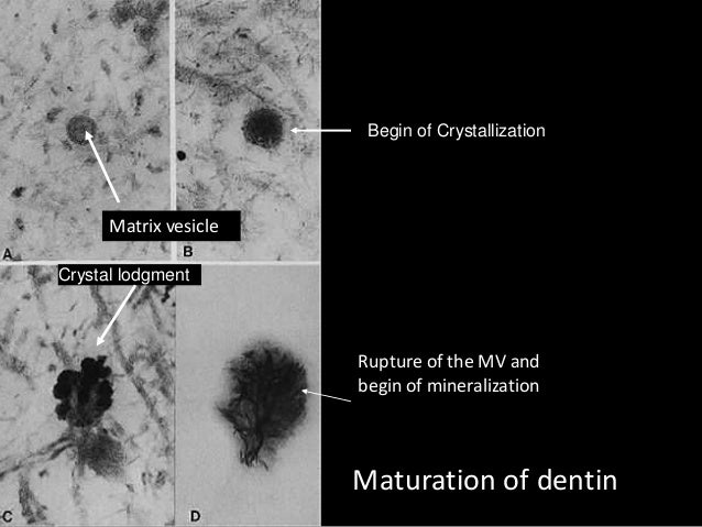 dentin pattern of mineralization, 1ry 2nd 3ry dentin formation and ro…