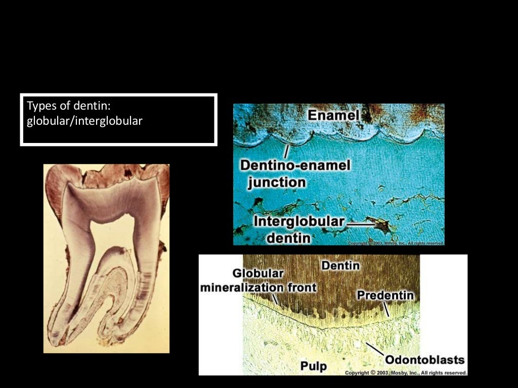 dentin pattern of mineralization, 1ry 2nd 3ry dentin formation and ro…