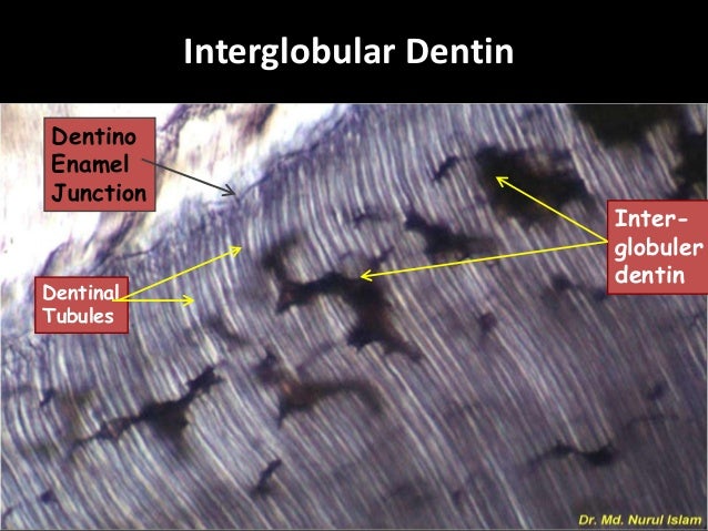 dentin pattern of mineralization, 1ry 2nd 3ry dentin formation and ro…