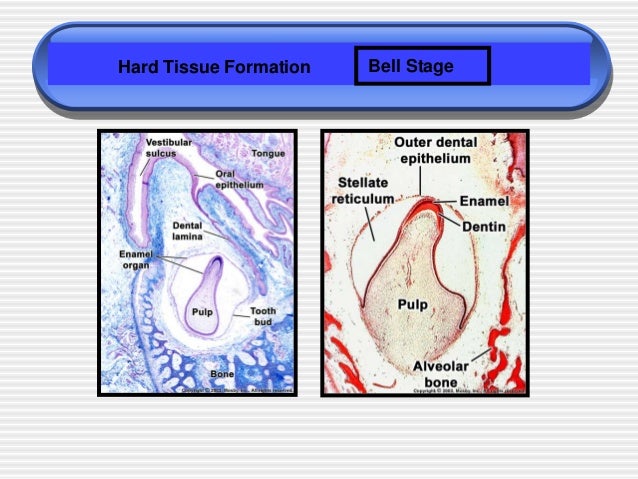 dentin pattern of mineralization, 1ry 2nd 3ry dentin formation and ro…
