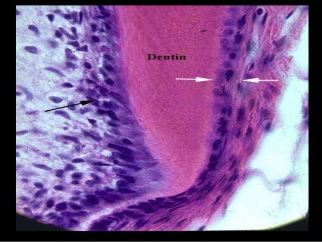 dentin pattern of mineralization, 1ry 2nd 3ry dentin formation and ro…