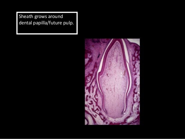 dentin pattern of mineralization, 1ry 2nd 3ry dentin formation and ro…