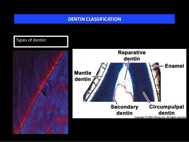 dentin pattern of mineralization, 1ry 2nd 3ry dentin formation and ro…