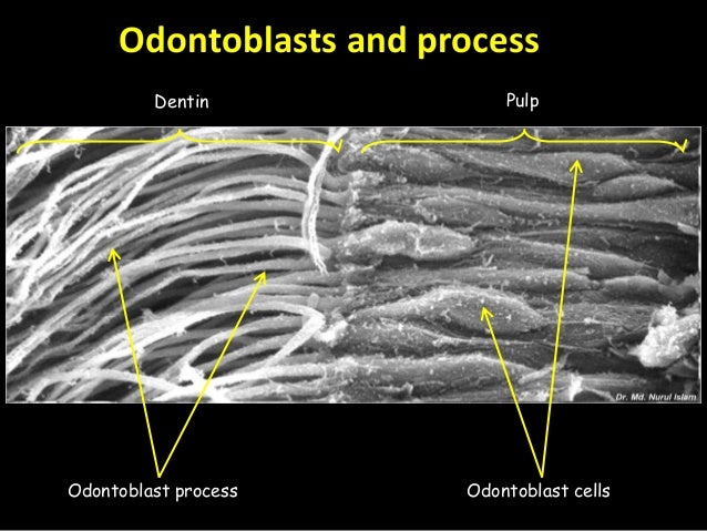dentin pattern of mineralization, 1ry 2nd 3ry dentin formation and ro…