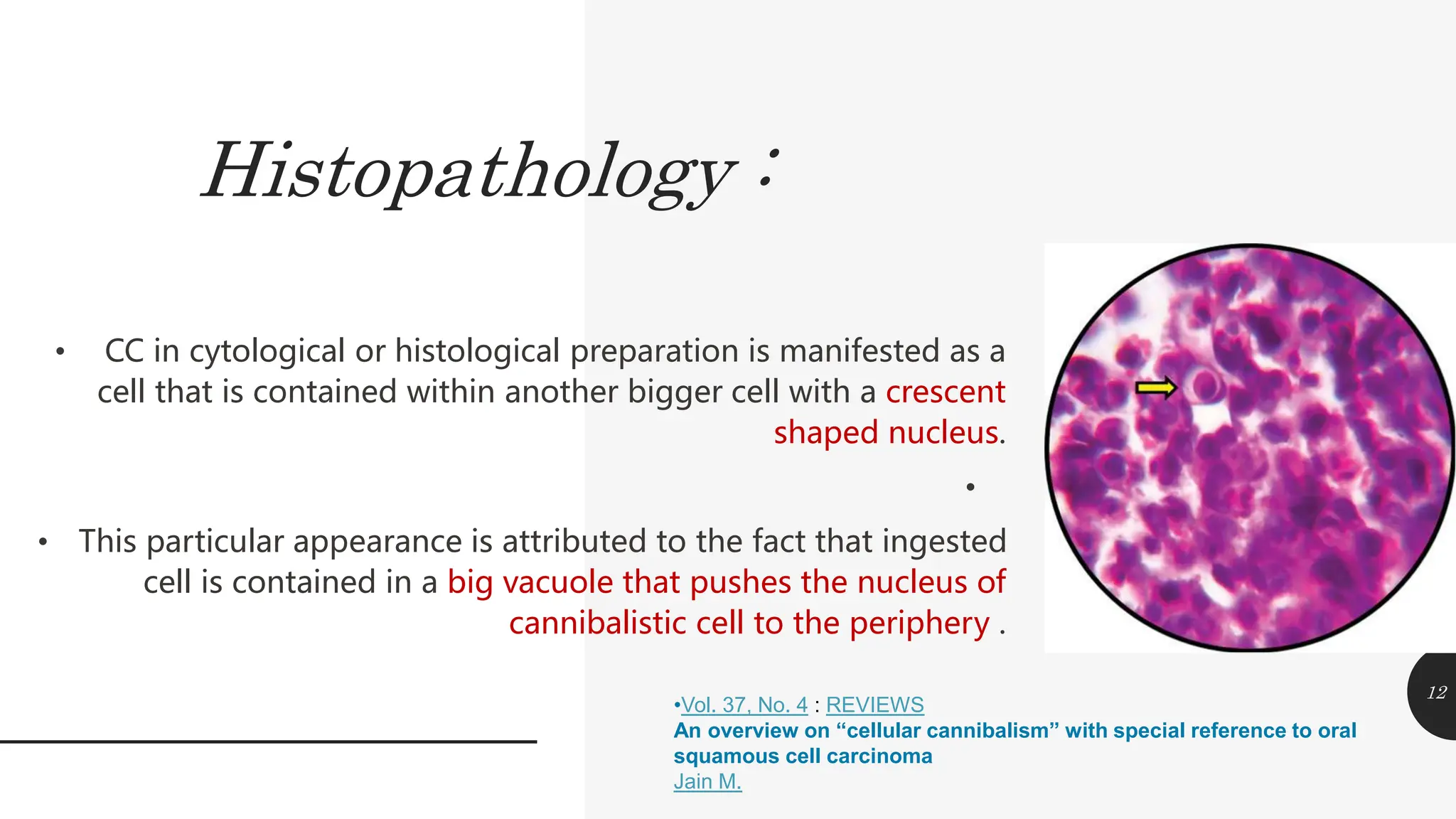 Emperipolesis , Entosis , Cell Cannibalism main.pptx