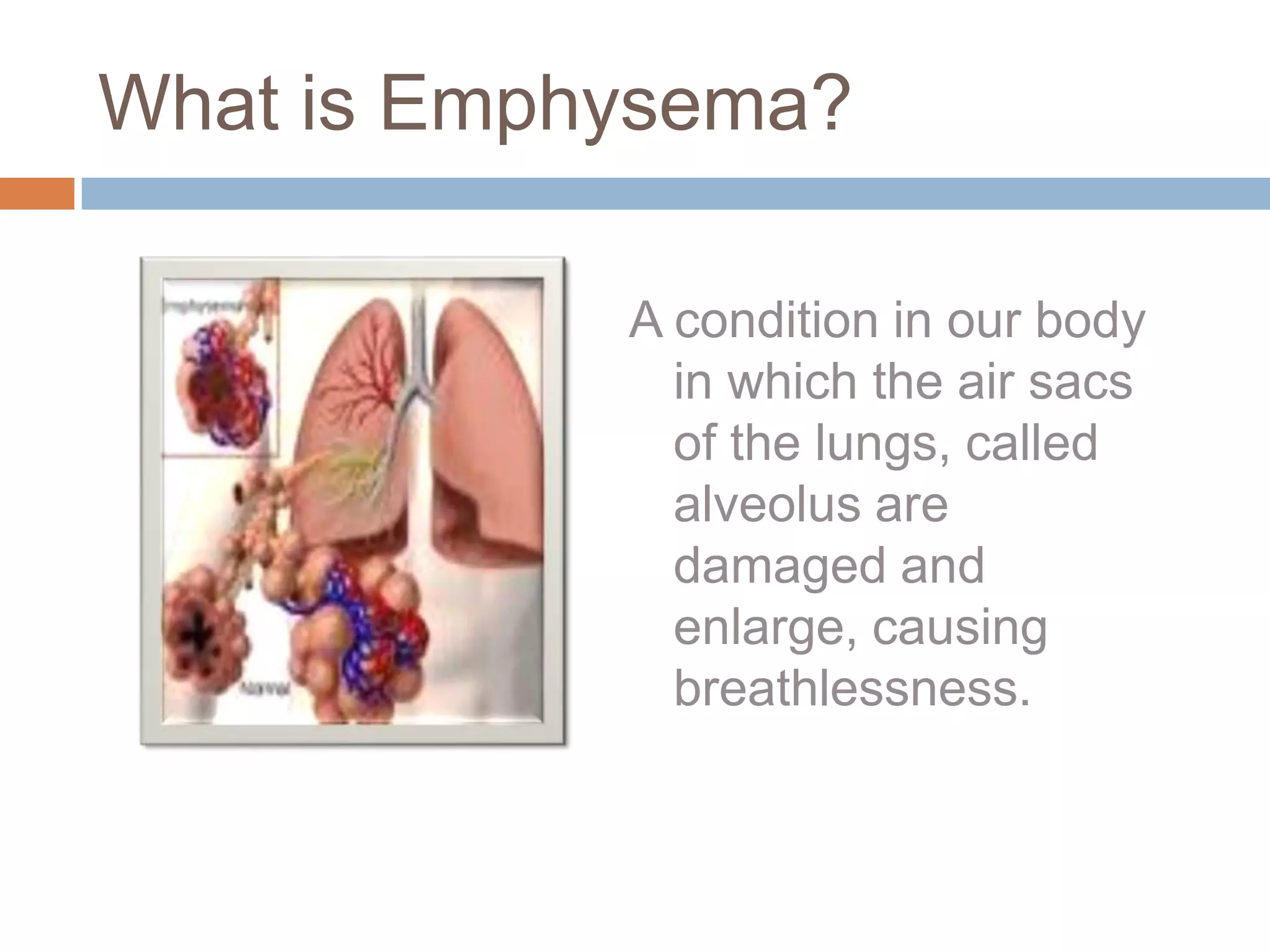 Emphysema | PPTX