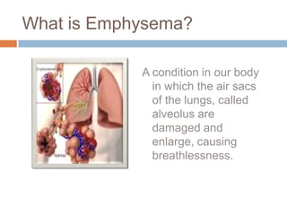 Emphysema | PPTX