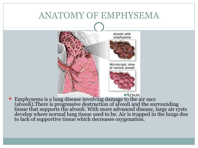 Emphysema | PPT | Lung and Respiratory Health | Diseases and Conditions