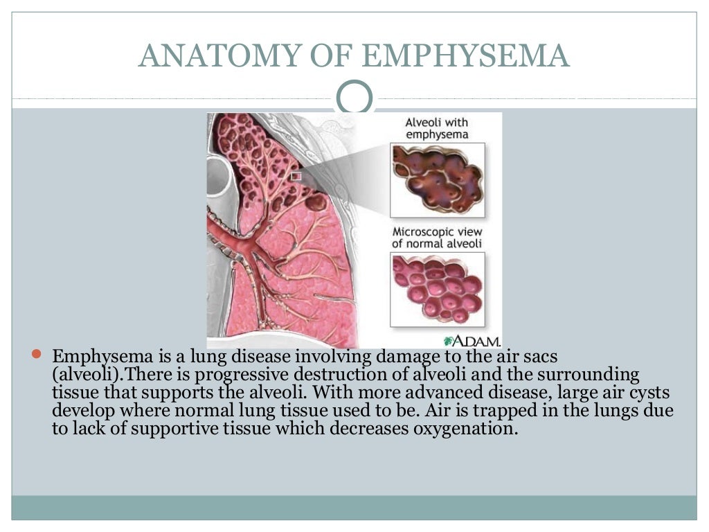 Emphysema
