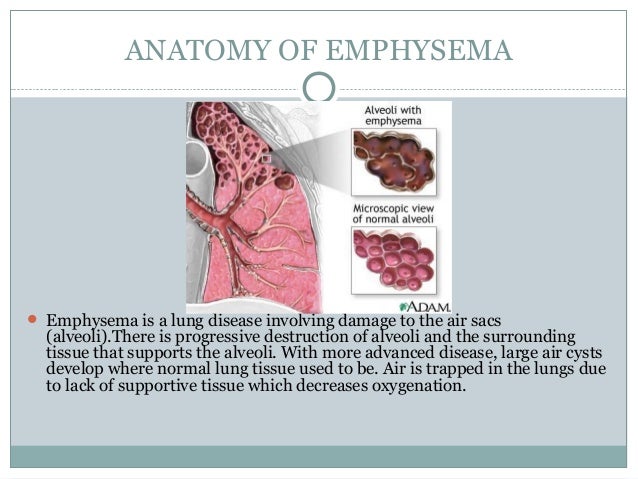 Emphysema
