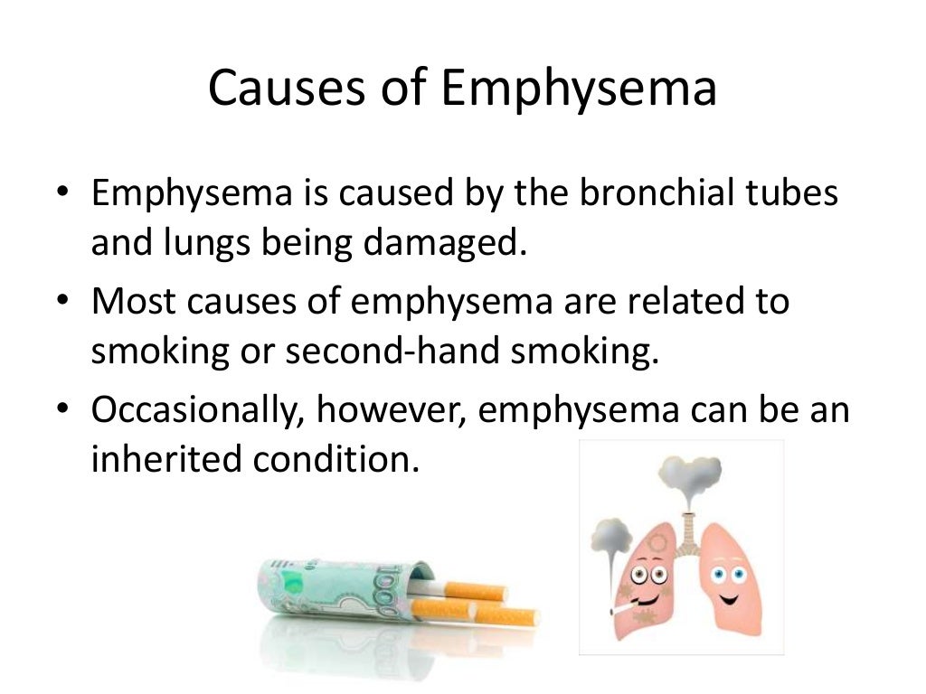 Emphysema - Symptoms & Causes: A Quick Overview