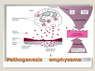 Emphysema | PPT