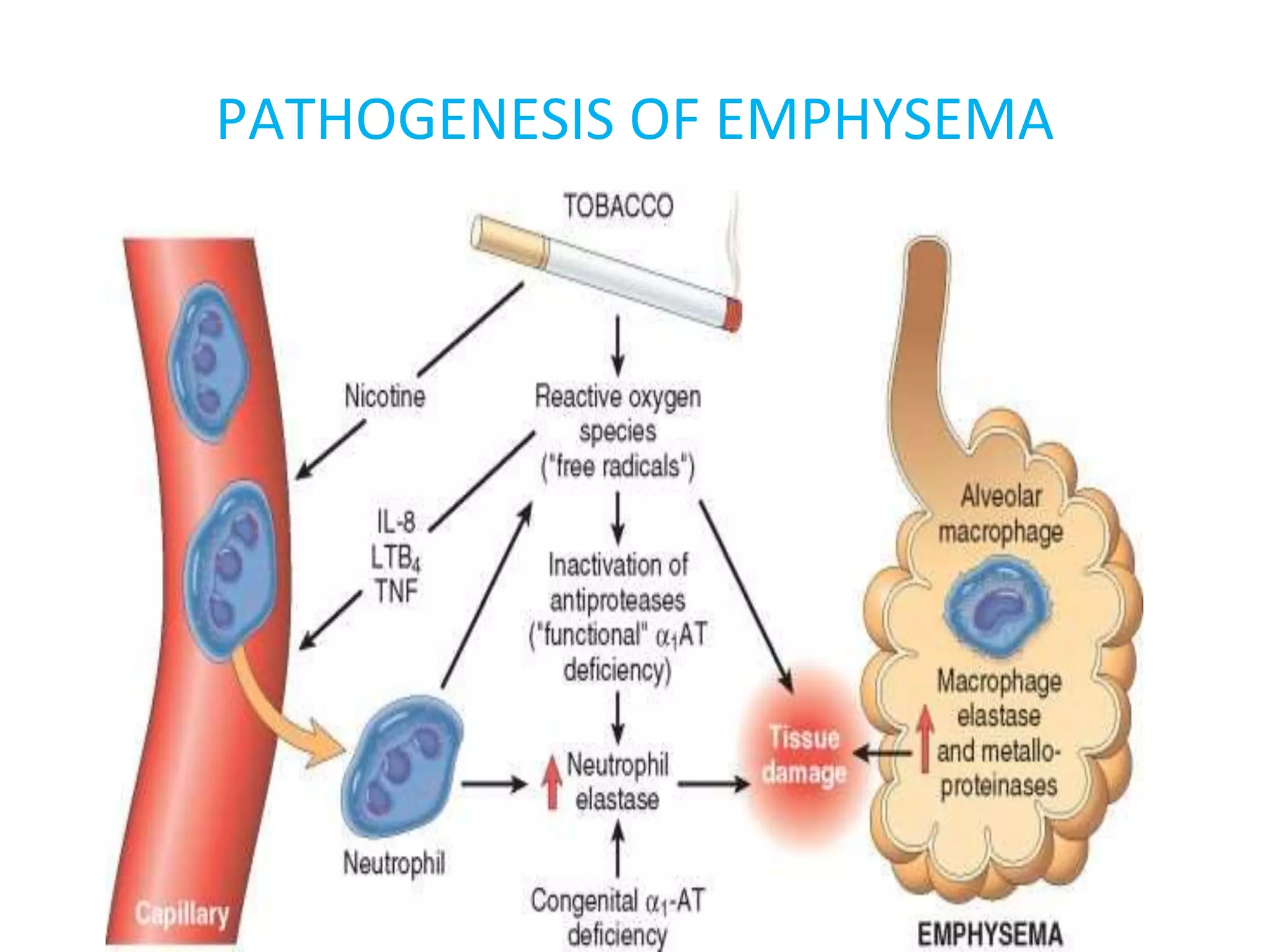 Emphysema | PPTX