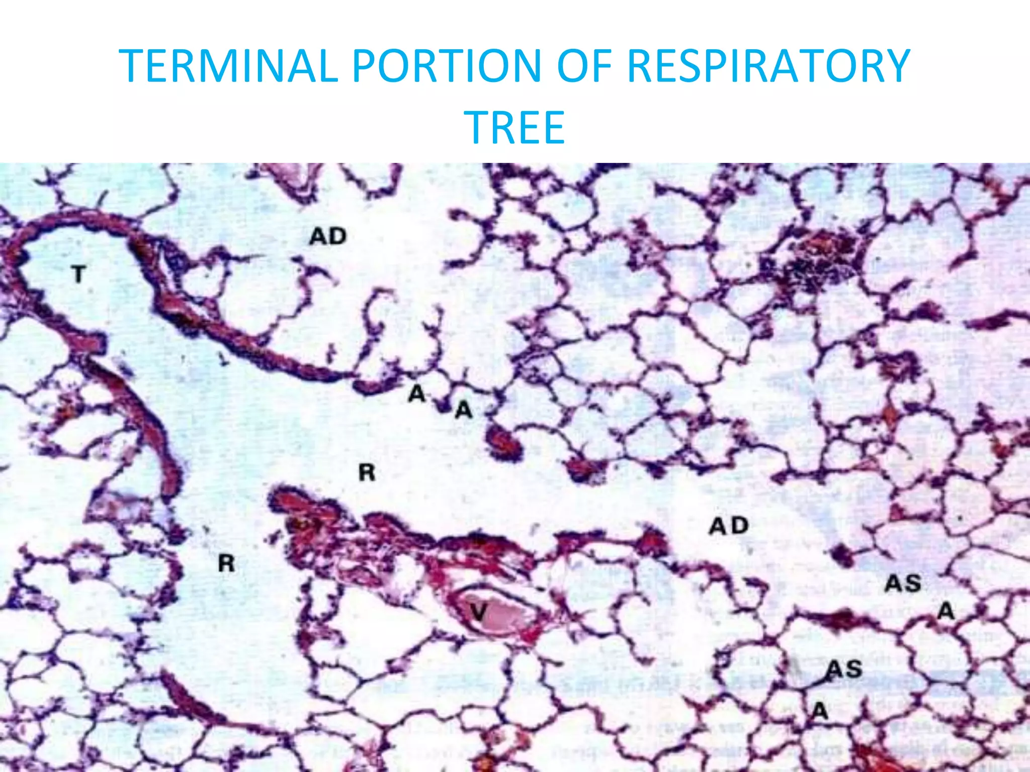 Emphysema | PPTX