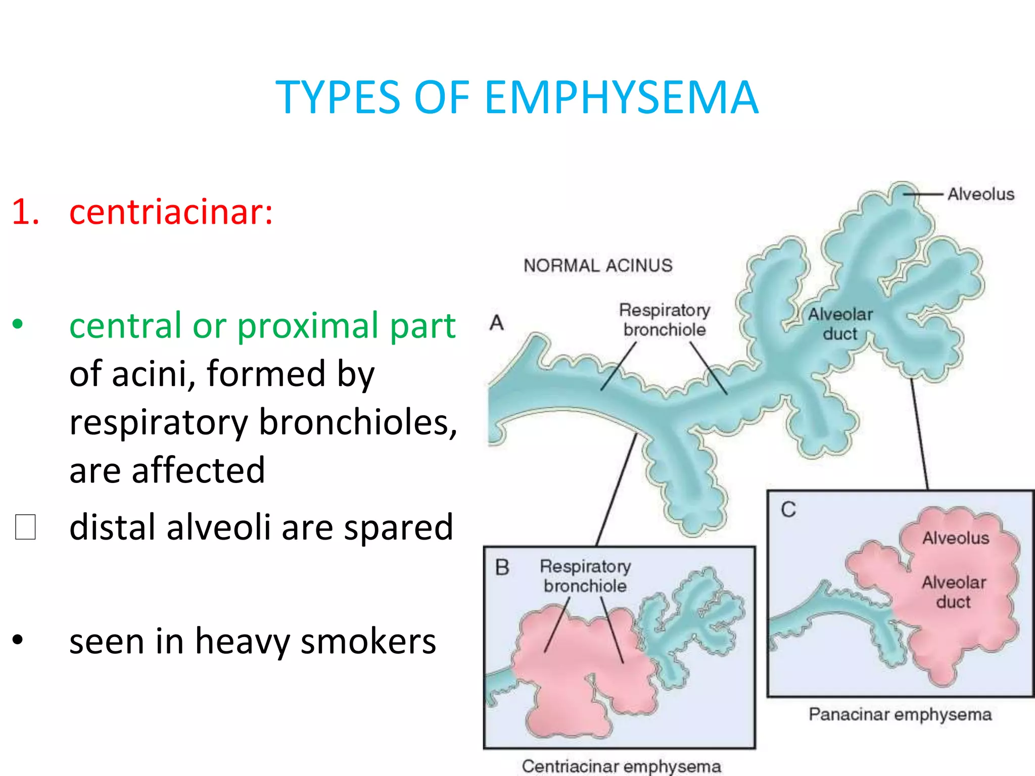 Emphysema | PPTX