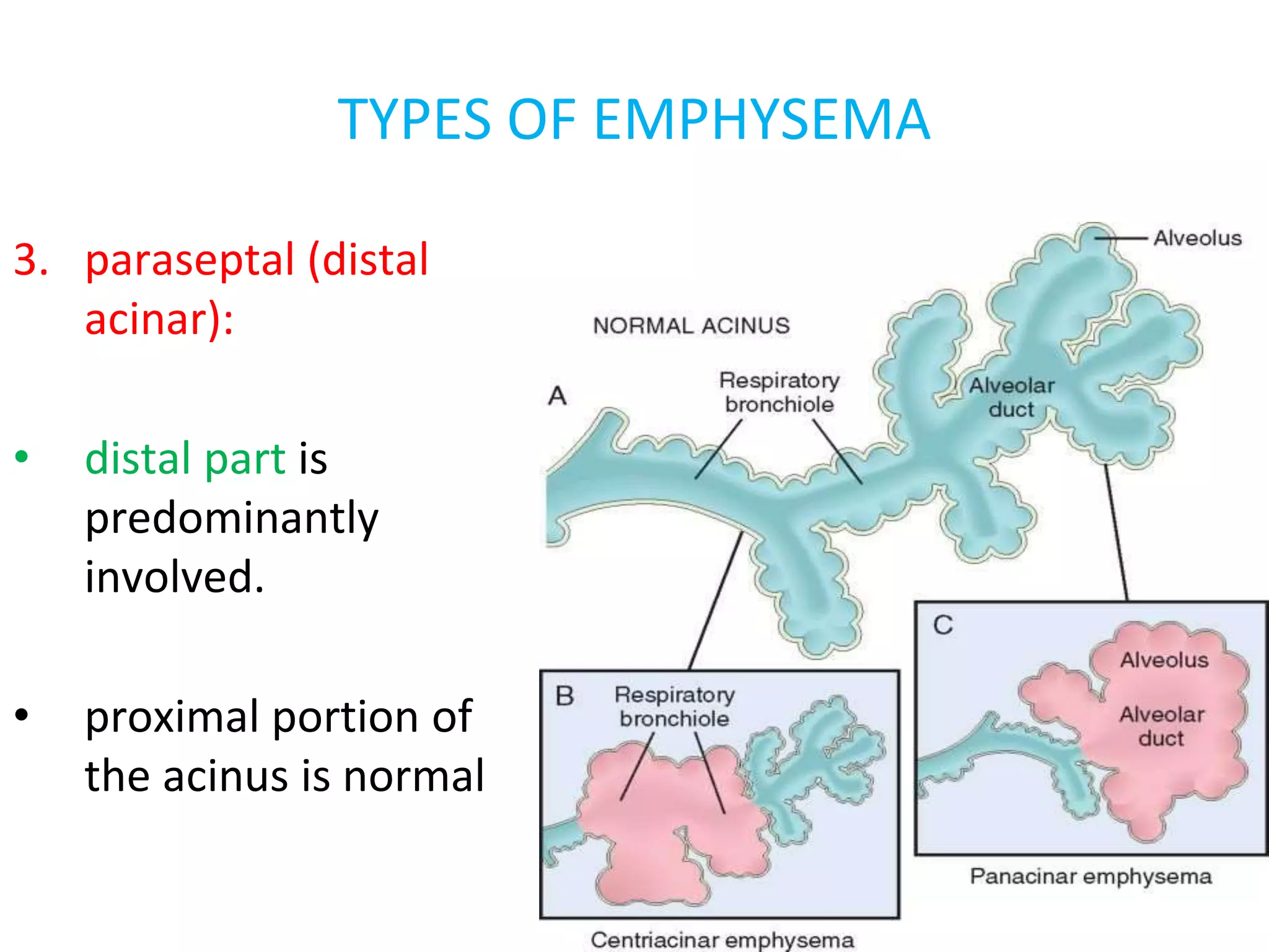 Emphysema | PPTX