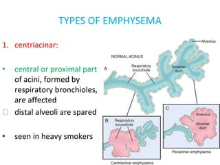 Emphysema | PPTX