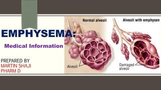 Emphysema-medical information |management |diagnosis | tests | PPTX ...