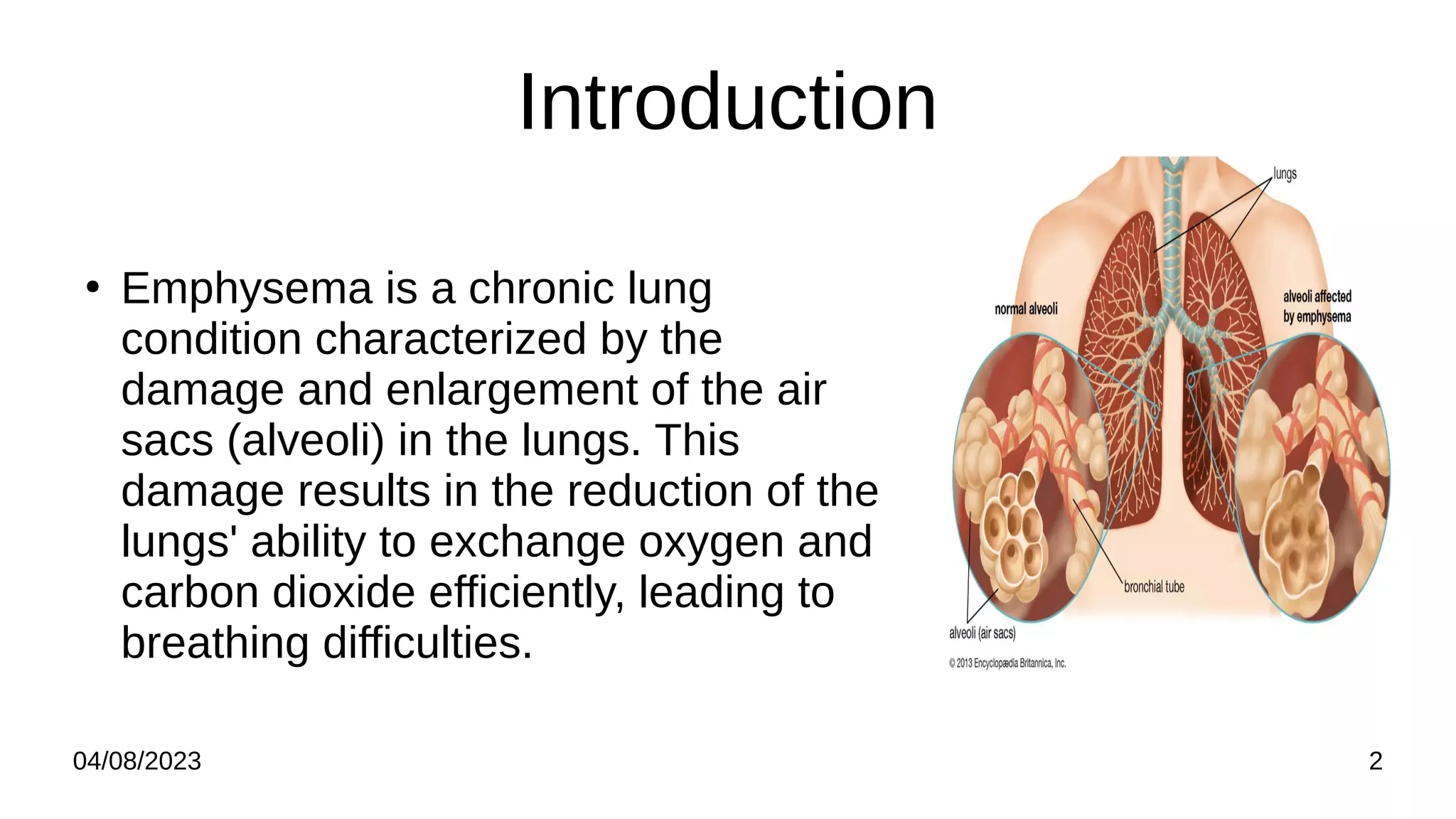 EMPHYSEMA.pdf