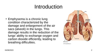 EMPHYSEMA.pdf | Free Download