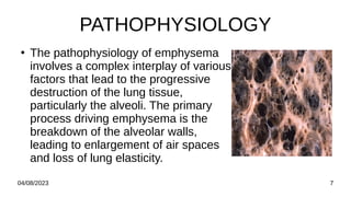 EMPHYSEMA.pdf | Free Download