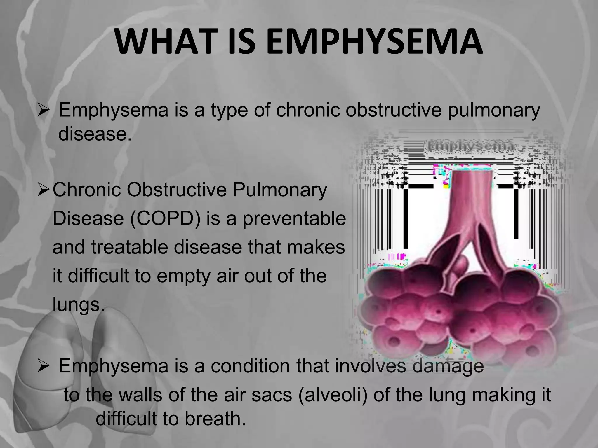 Emphysema.pptx
