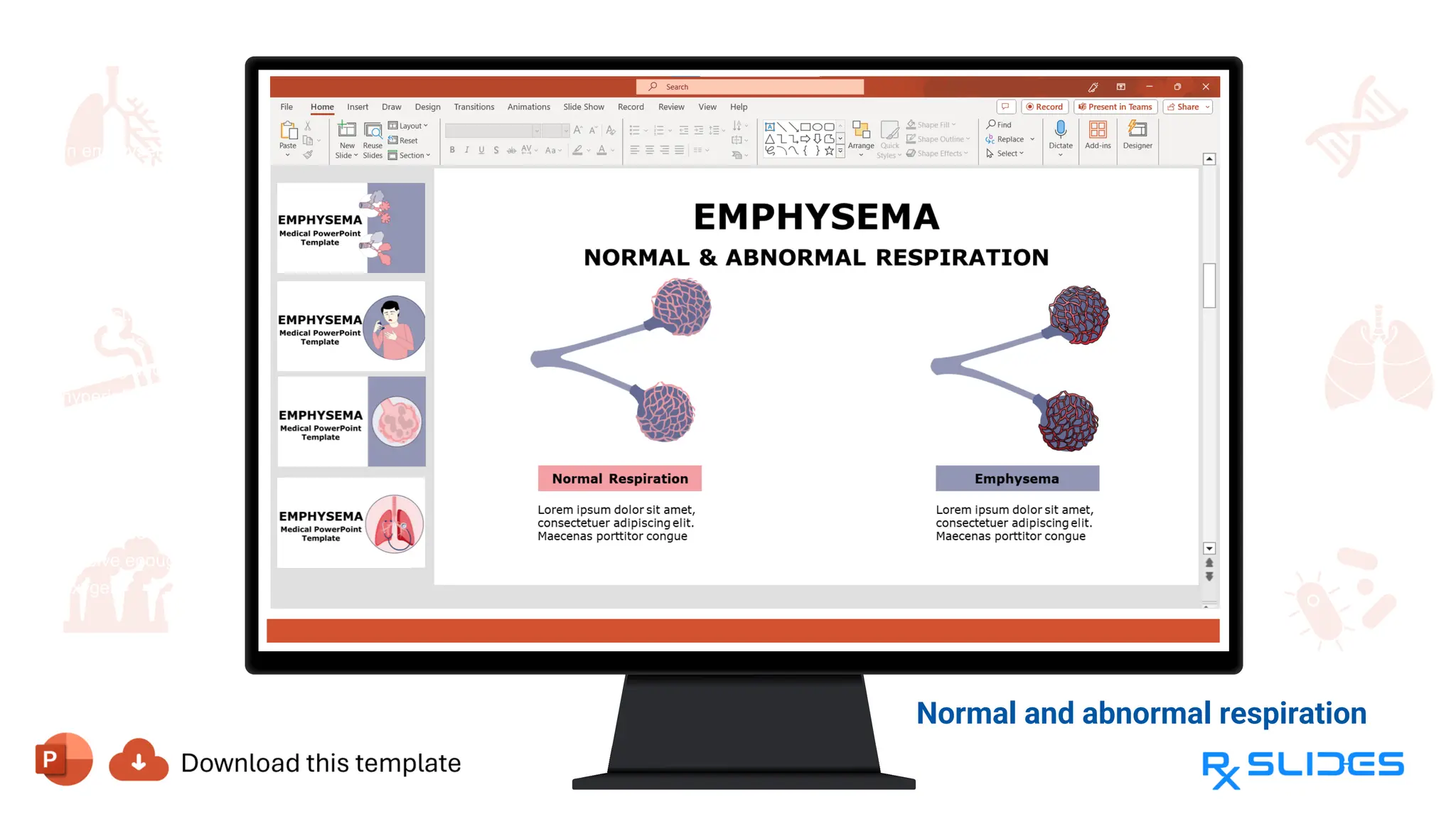 Emphysema | PPT